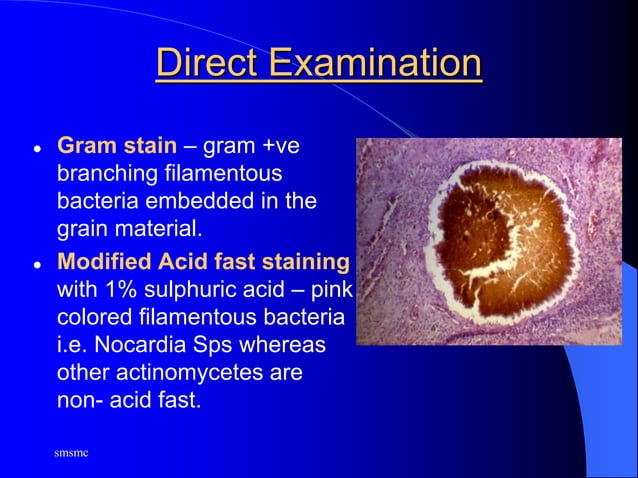 Subcutaneous mycoses | PPT | Infectious Diseases | Diseases and Conditions