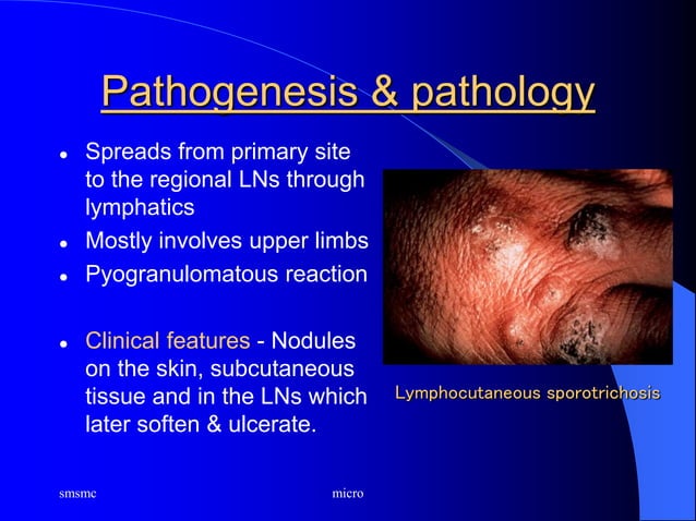 Subcutaneous mycoses | PPT | Infectious Diseases | Diseases and Conditions