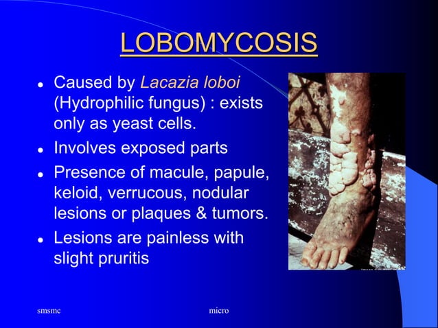 Subcutaneous mycoses | PPT | Infectious Diseases | Diseases and Conditions