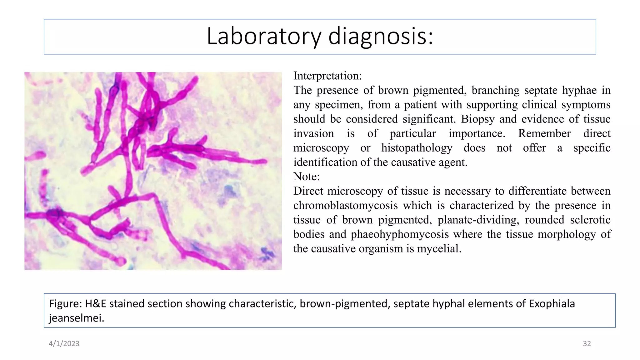 Subcutaneous Mycoses.pptx