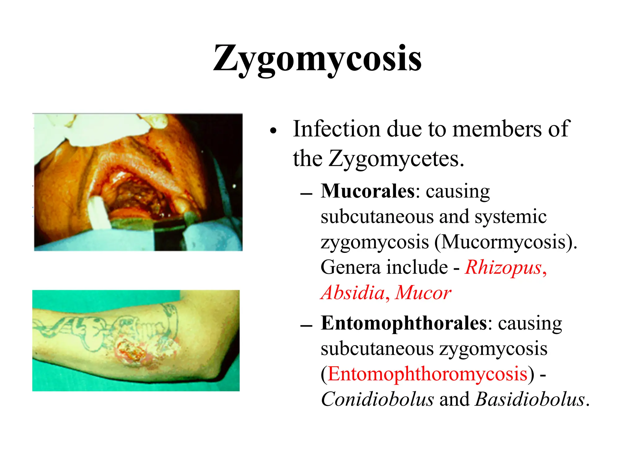 SUBCUTANEOUS MYCOSES(fungi) presentation.pdf