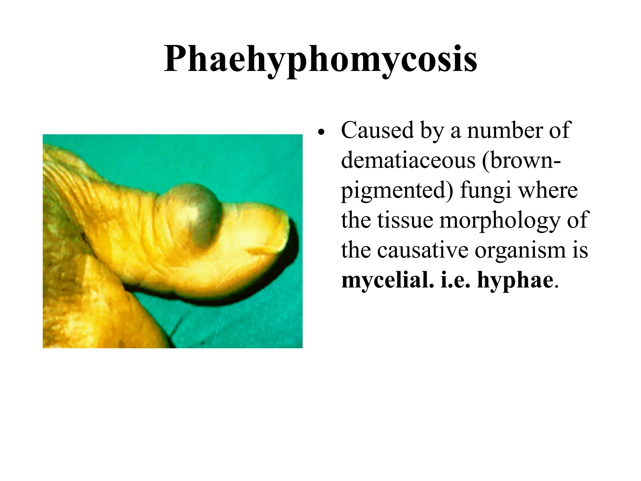 SUBCUTANEOUS MYCOSES(fungi) presentation.pdf