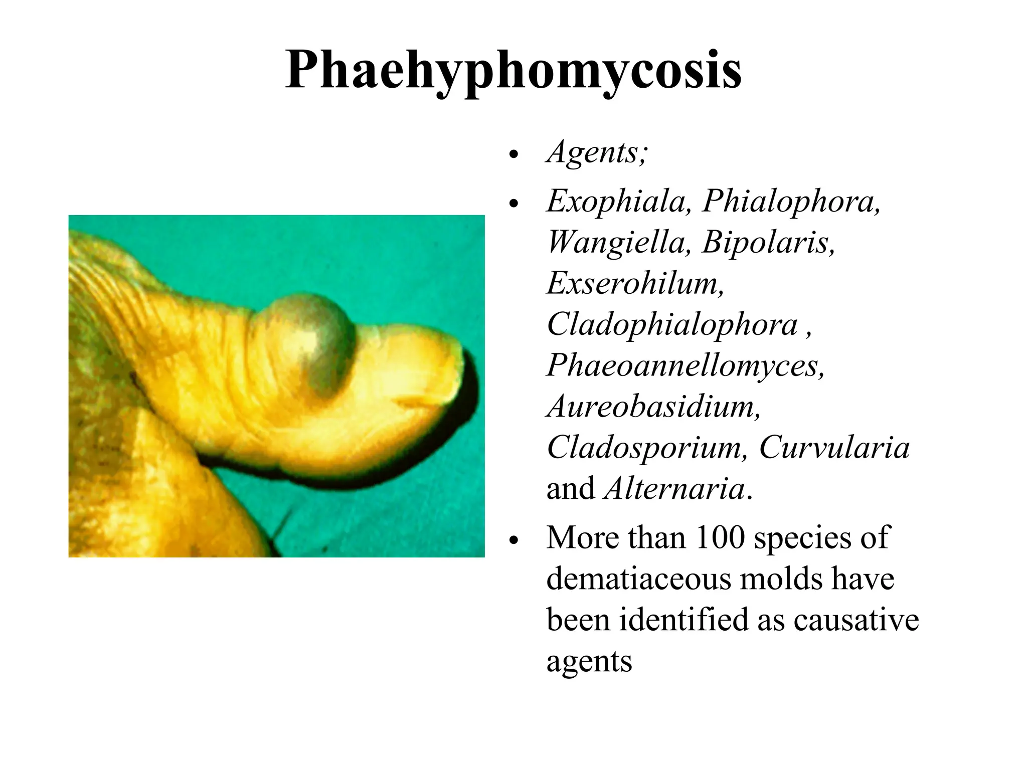 SUBCUTANEOUS MYCOSES(fungi) presentation.pdf