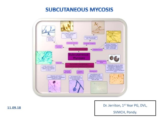 Subcutaneous Mycosis | PPTX | Skin and Dermatology | Diseases and ...