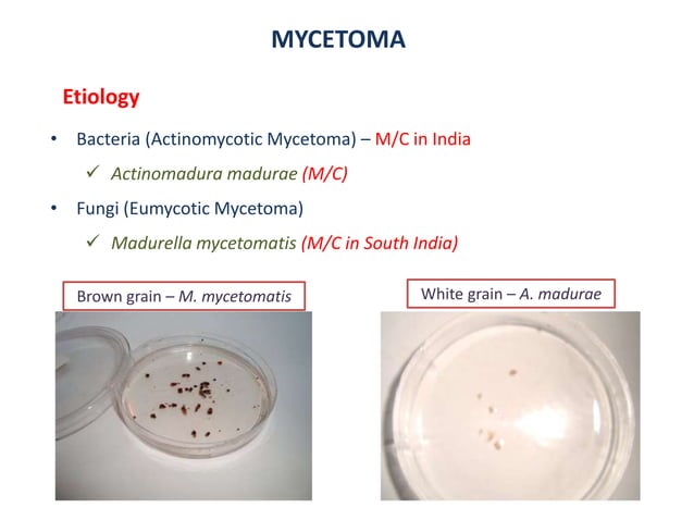 Subcutaneous Mycosis | PPTX | Skin and Dermatology | Diseases and ...