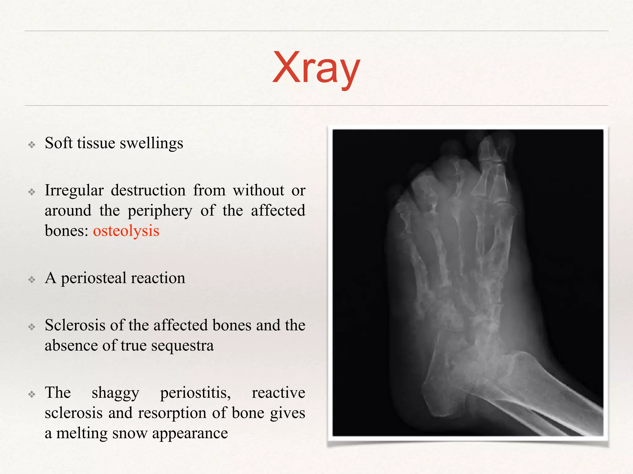 Subcutaneous mycosis | PPTX