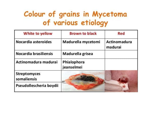 Subcutaneous mycosis | PPT