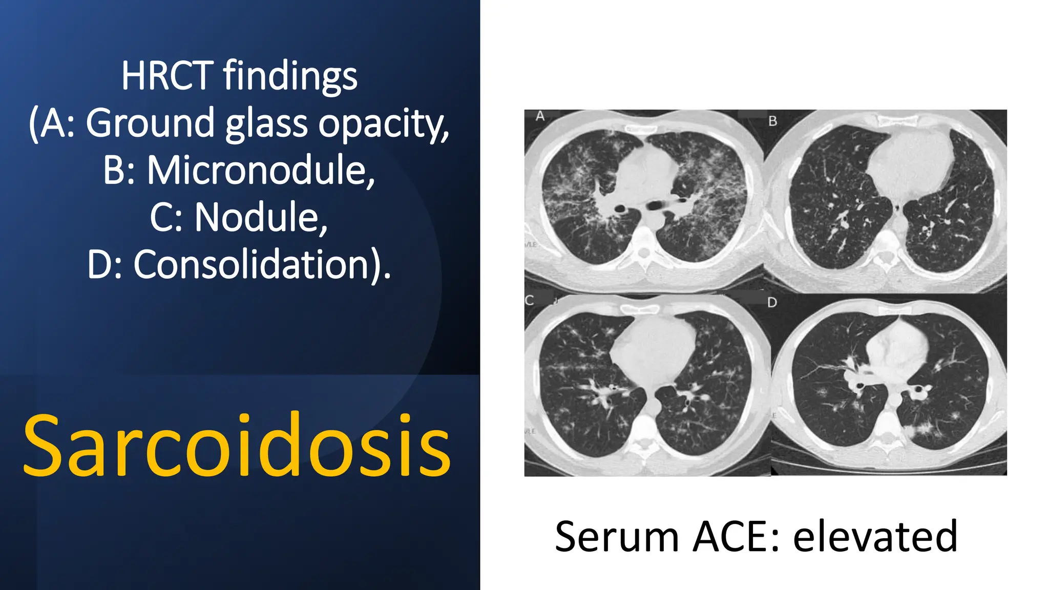 Subcutaneous nodules in rheumatic diseases Ahmed Yehia Assistant ...