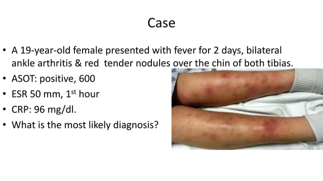 Subcutaneous nodules in rheumatic diseases Ahmed Yehia Assistant ...