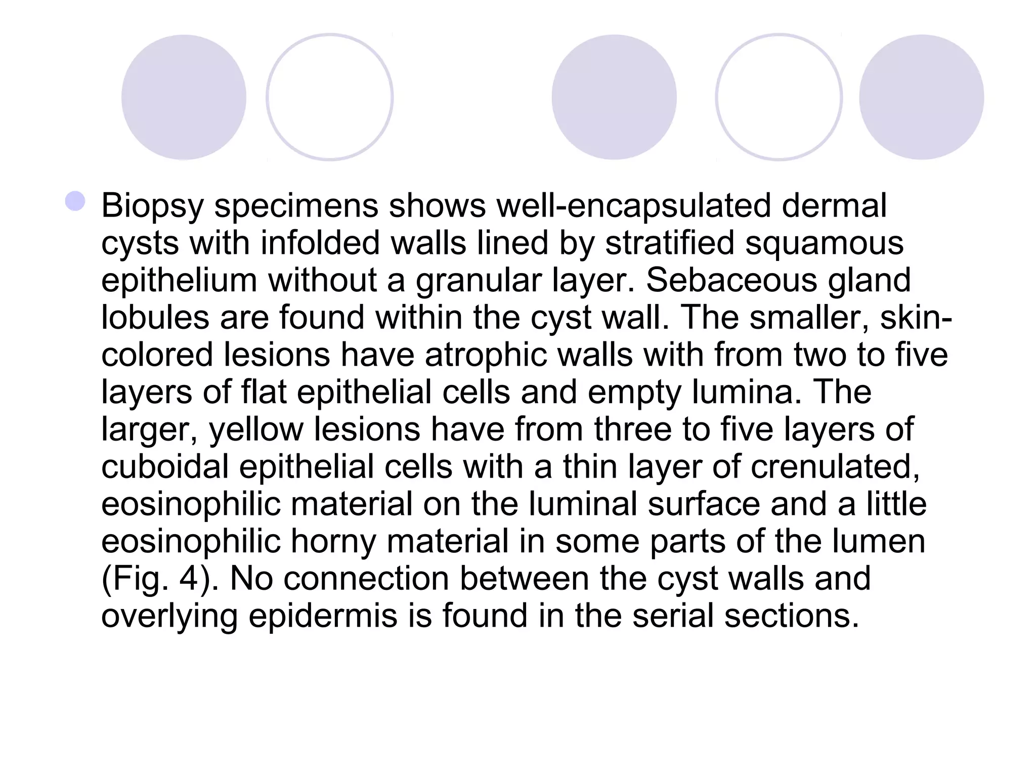 Subcutaneous nodules on the abdomen | PPT