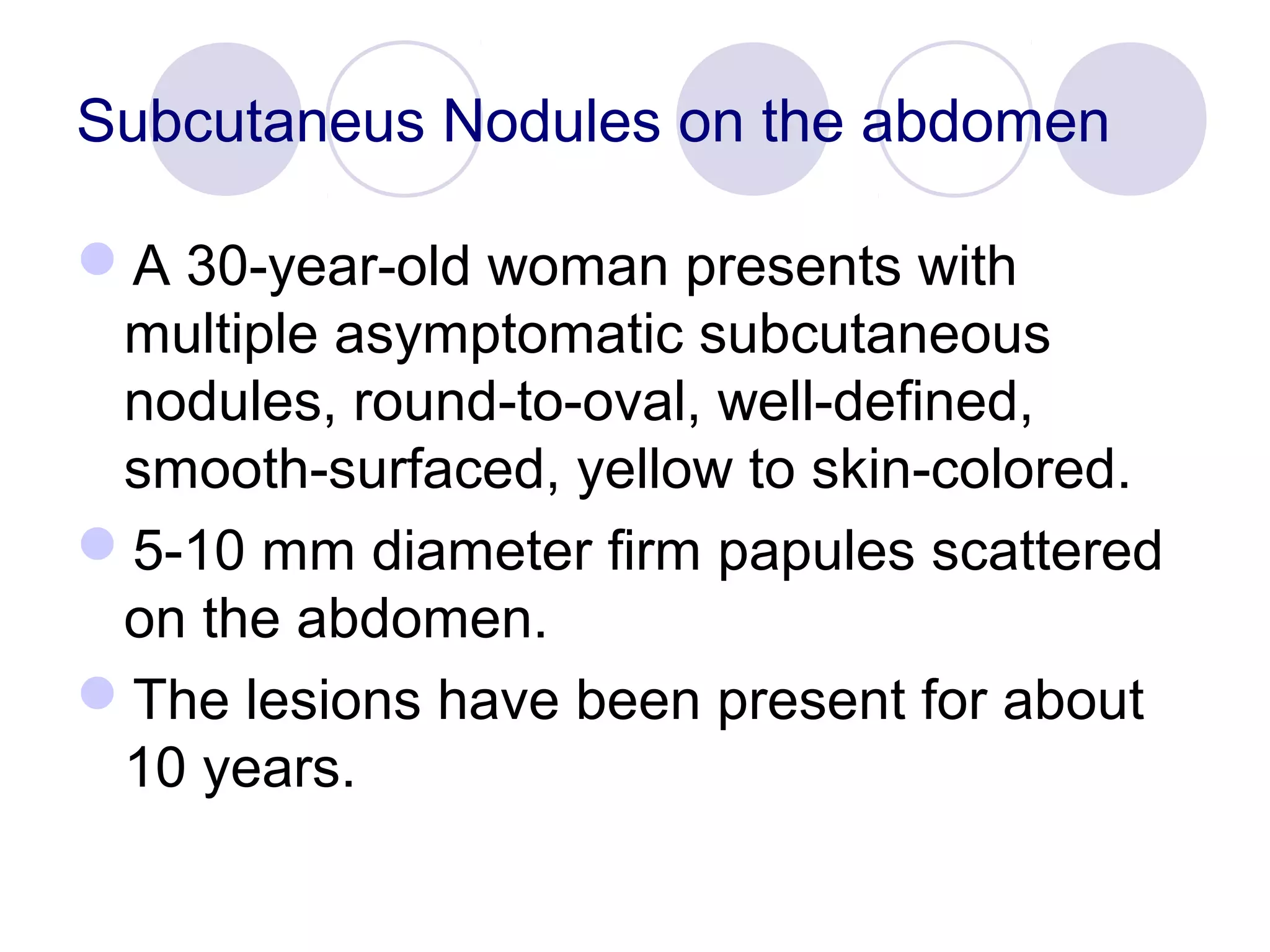 Subcutaneous nodules on the abdomen. | PPT | Skin and Dermatology ...