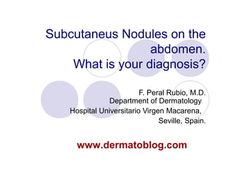 Subcutaneous nodules on the abdomen. | PPT