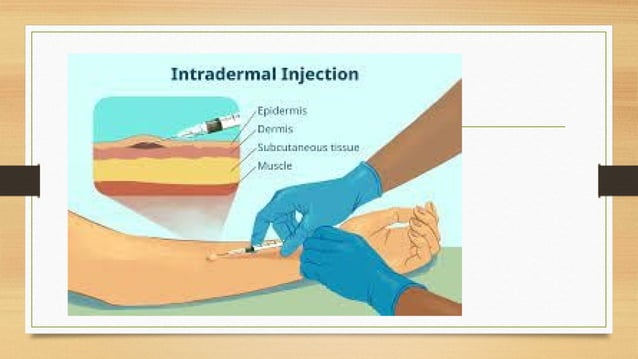 Subdermal injections.,indications ,sites. | PPT