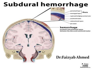 Subdural Hemorrhage