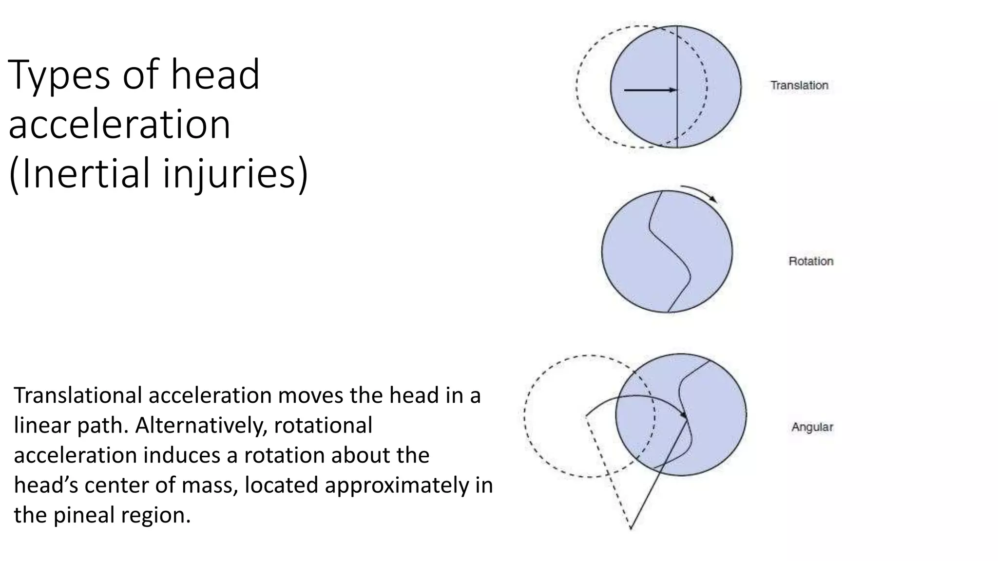 Subdural Hematoma | PPTX