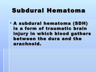 Subdural Hematoma | PPT
