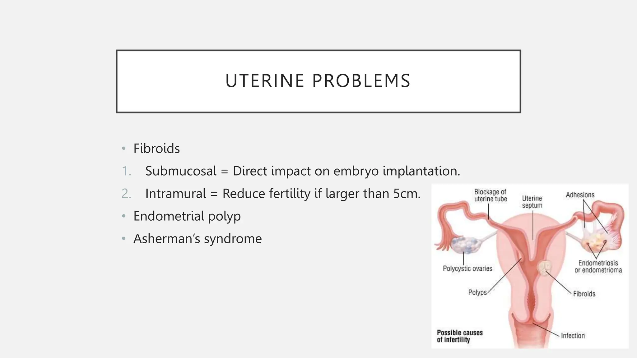 Subfertility | PPTX