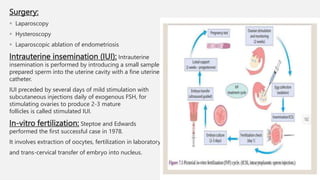 Subfertility | PPTX