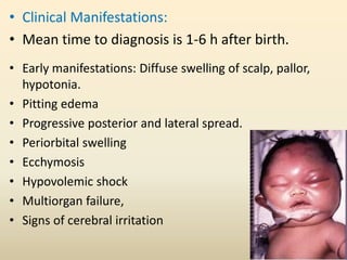Subgaleal Hemorrhage - Dr Padmesh - Neonatology | PPT