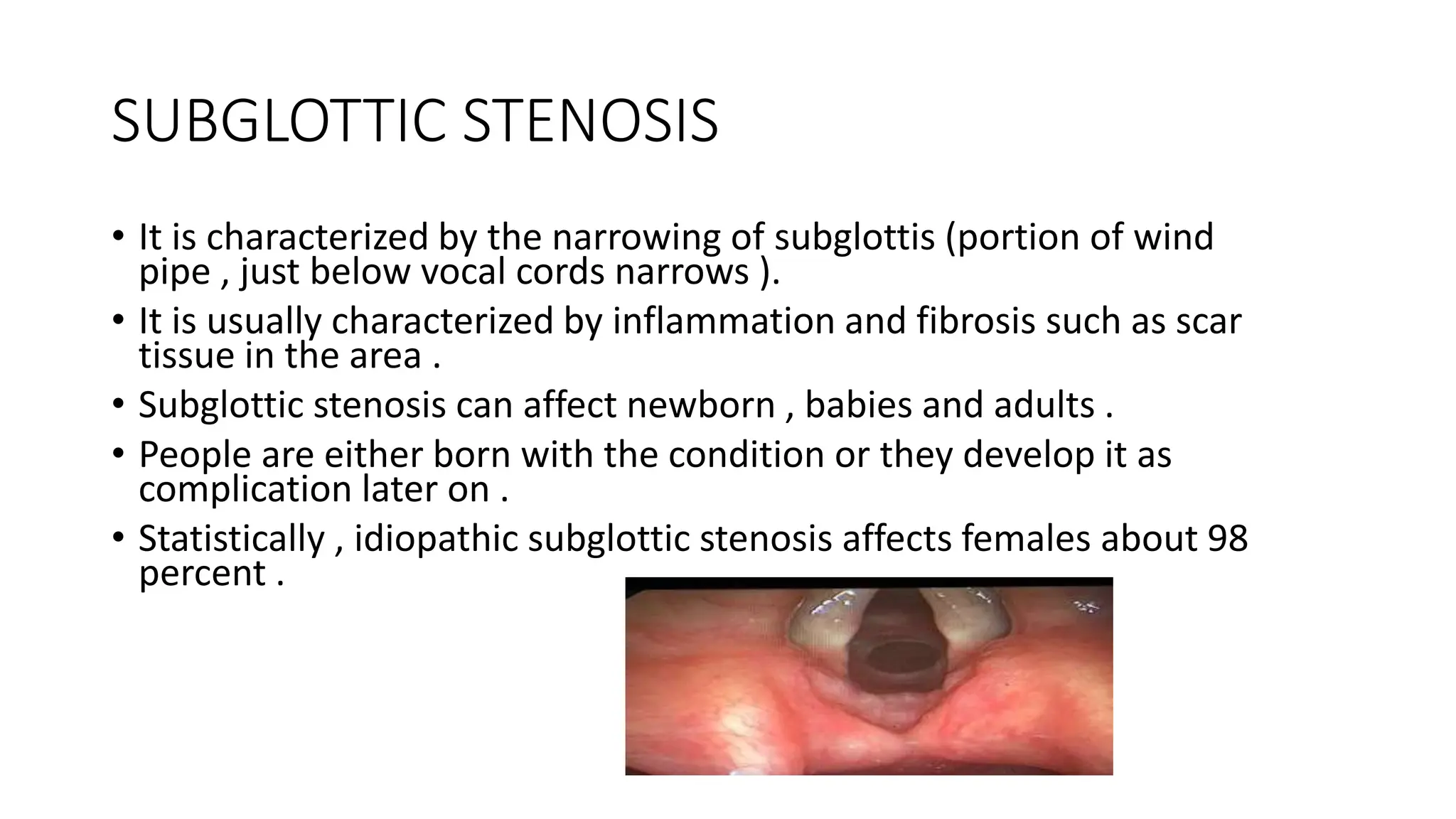 SUBGLOTTIC STENOSIS.pptx