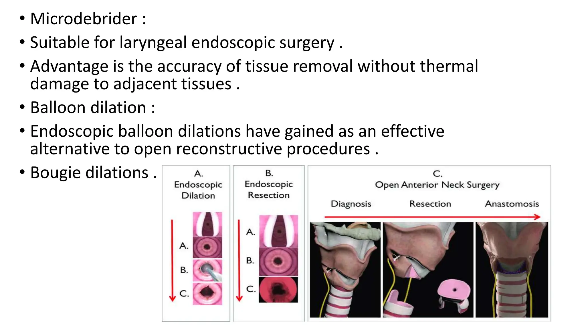 SUBGLOTTIC STENOSIS.pptx