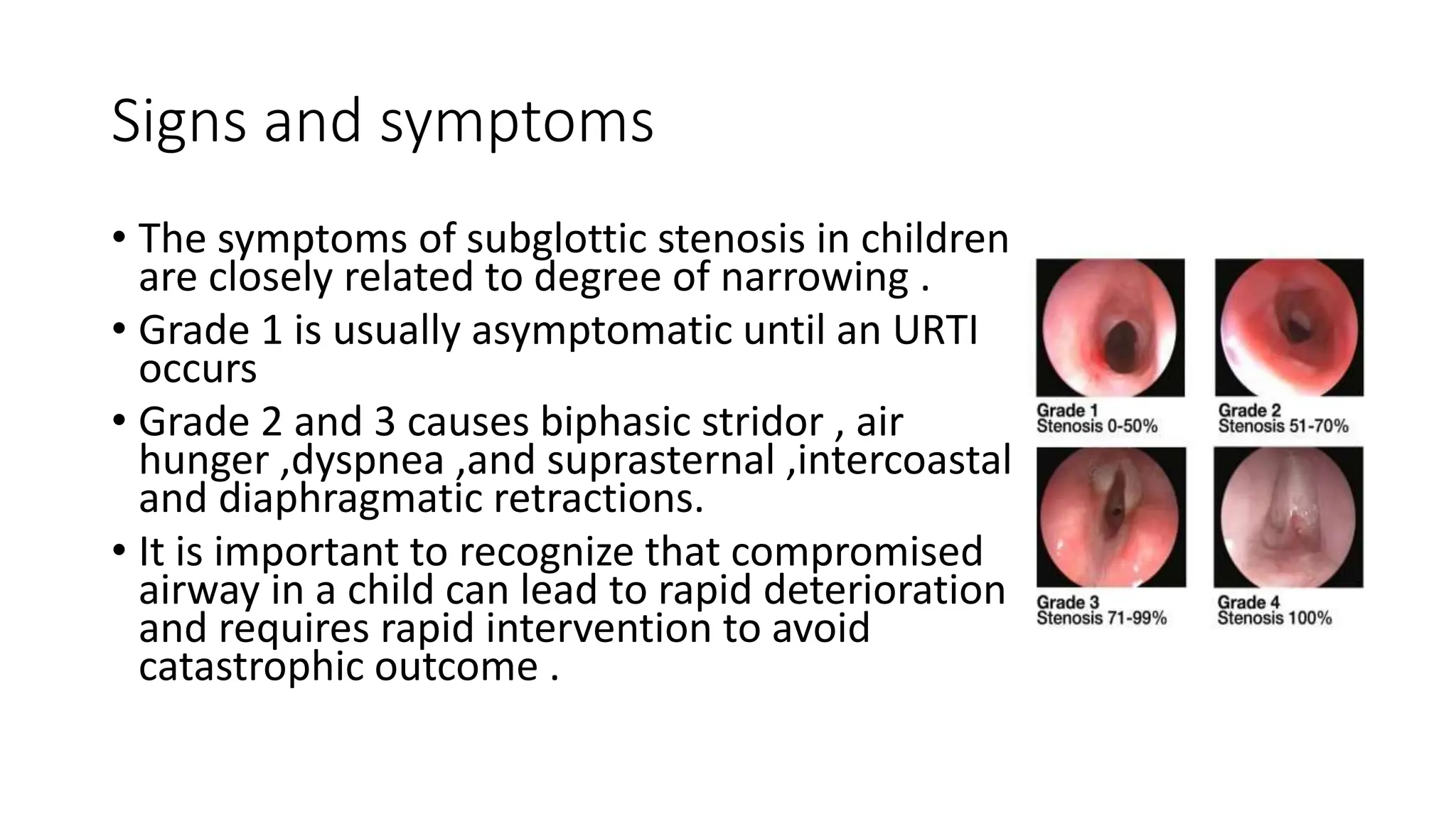 SUBGLOTTIC STENOSIS.pptx