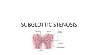 SUBGLOTTIC STENOSIS.pptx