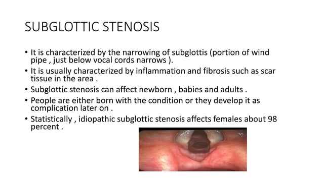 SUBGLOTTIC STENOSIS.pptx | Ear, Nose and Throat Conditions | Diseases ...