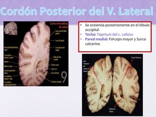 Meninges cerebroespinales y sistema ventricular | PPTX