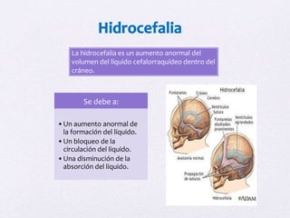 Meninges cerebroespinales y sistema ventricular | PPTX