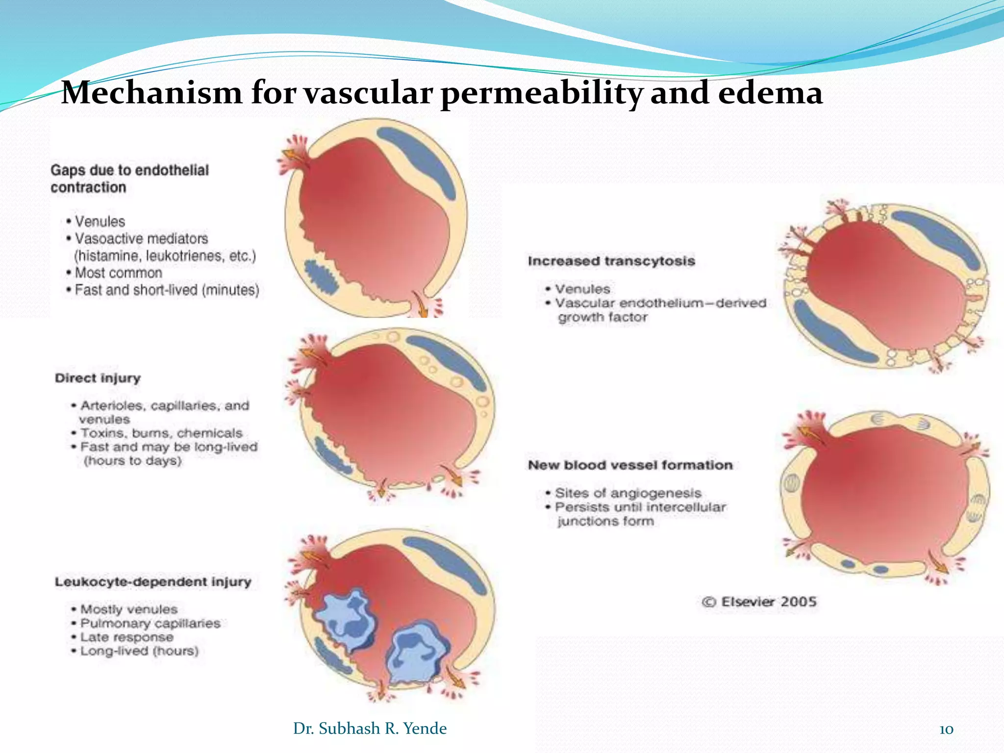 Mechanism of inflammation | PPT