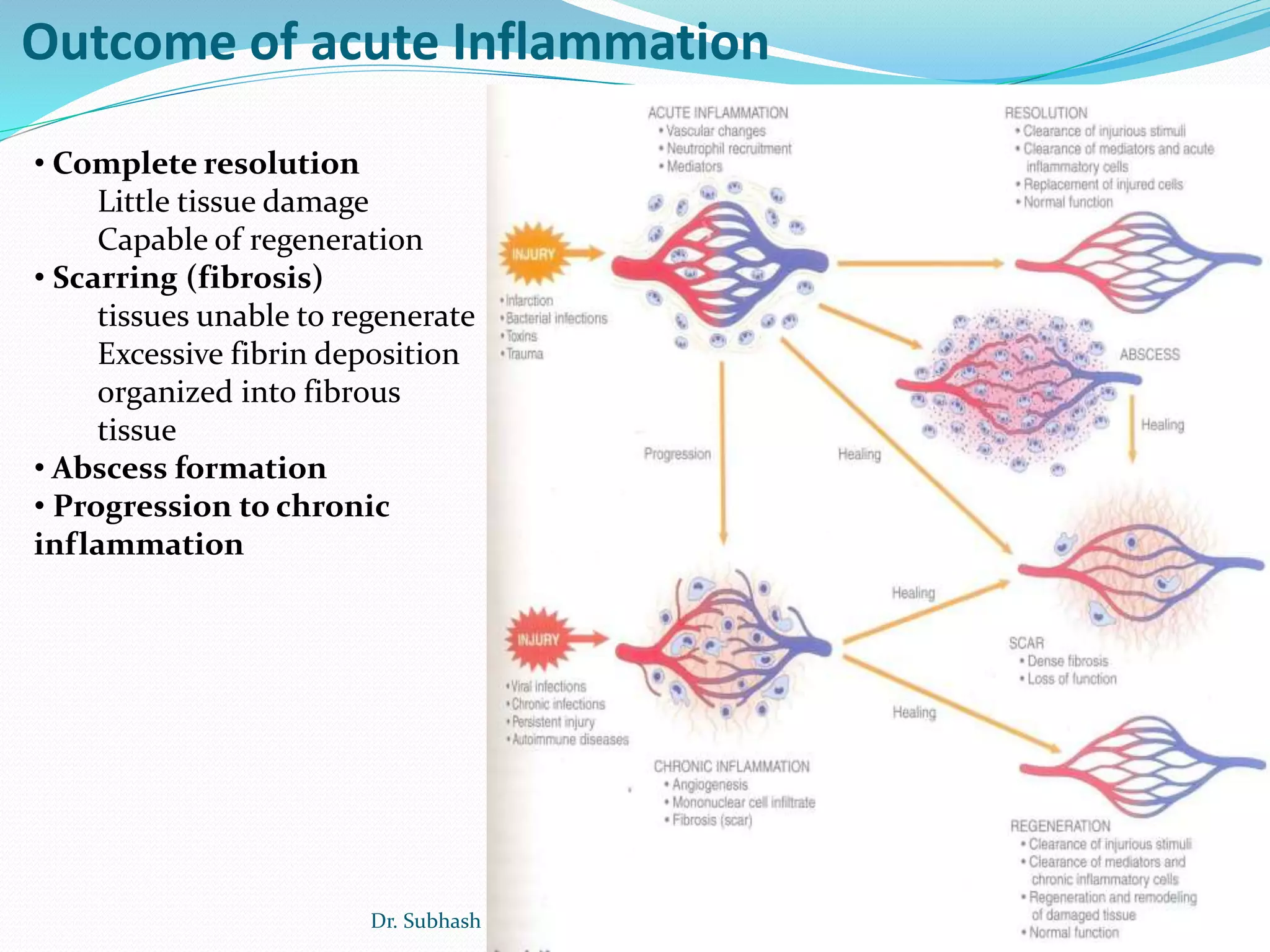 Mechanism of inflammation | PPT