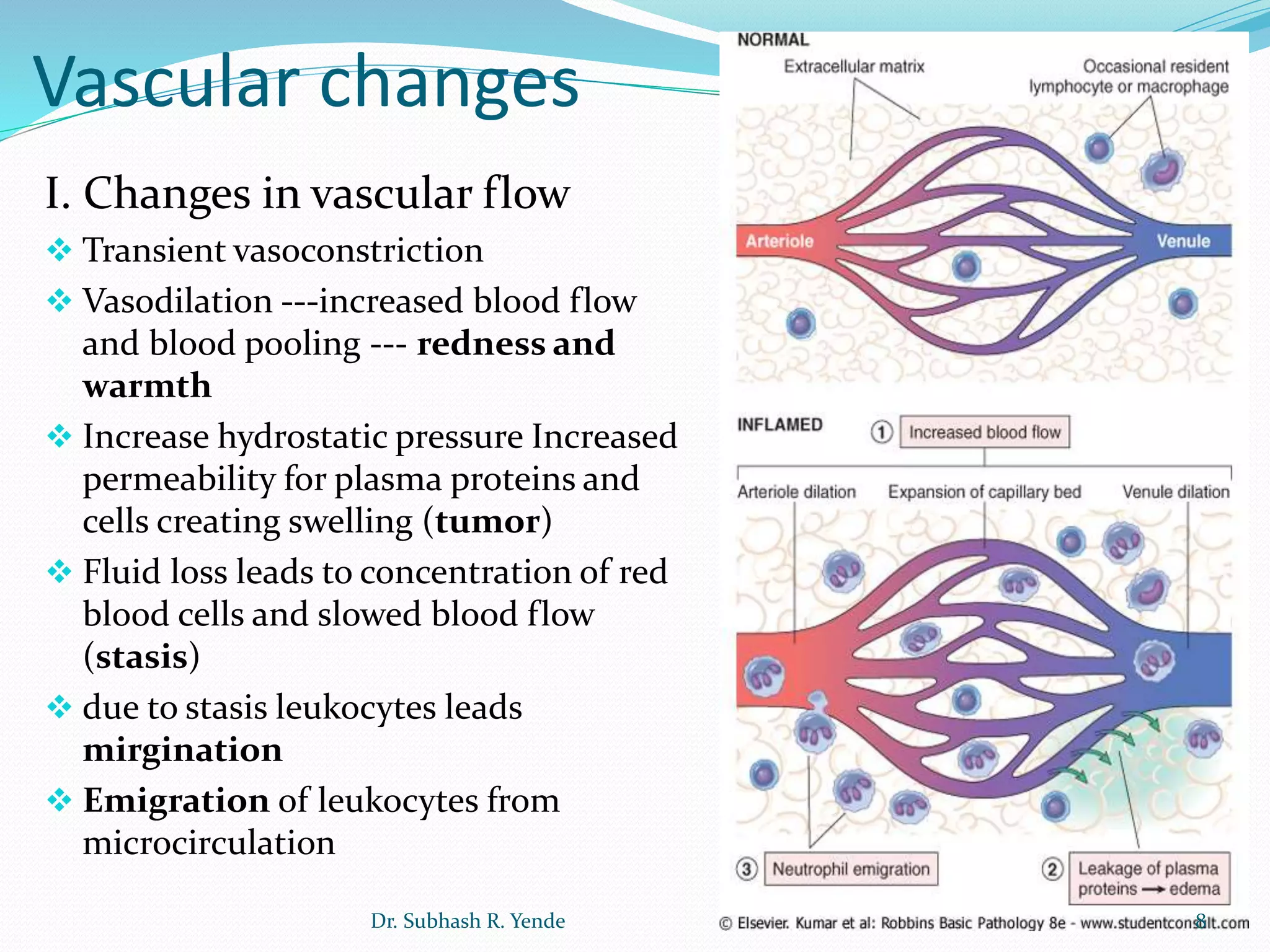 Mechanism of inflammation | PPT