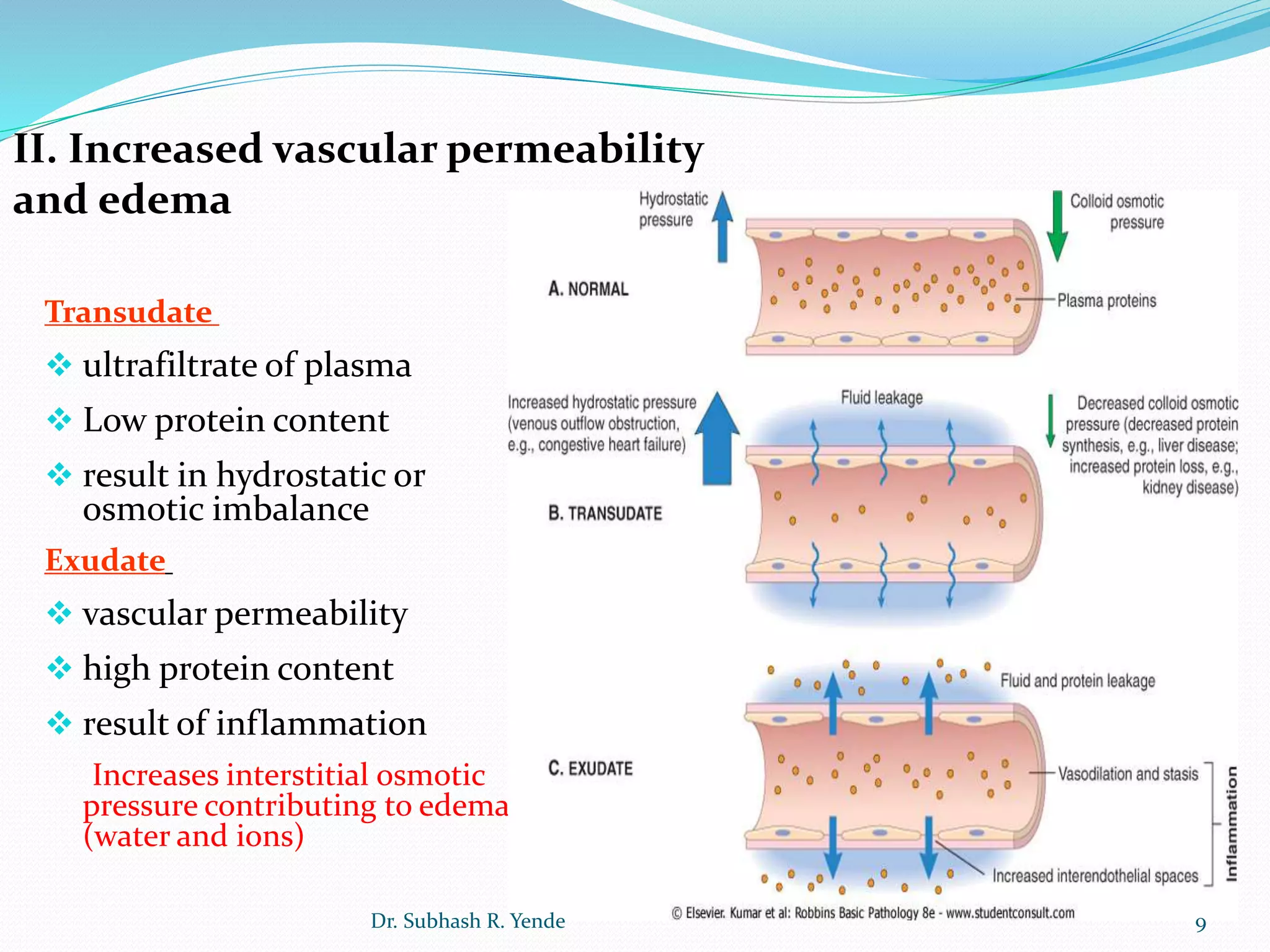 Mechanism of inflammation | PPT