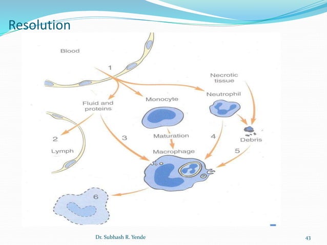 Mechanism of inflammation | PPT