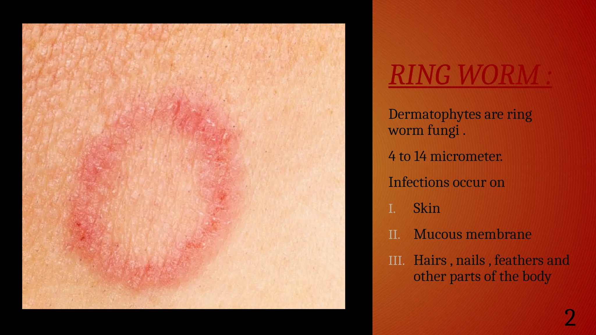 Biosafety related to Dermatophytes .pptx