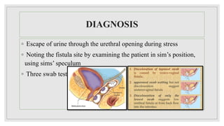 Subinvolution & UTI IN PUERPERIUM | PPTX