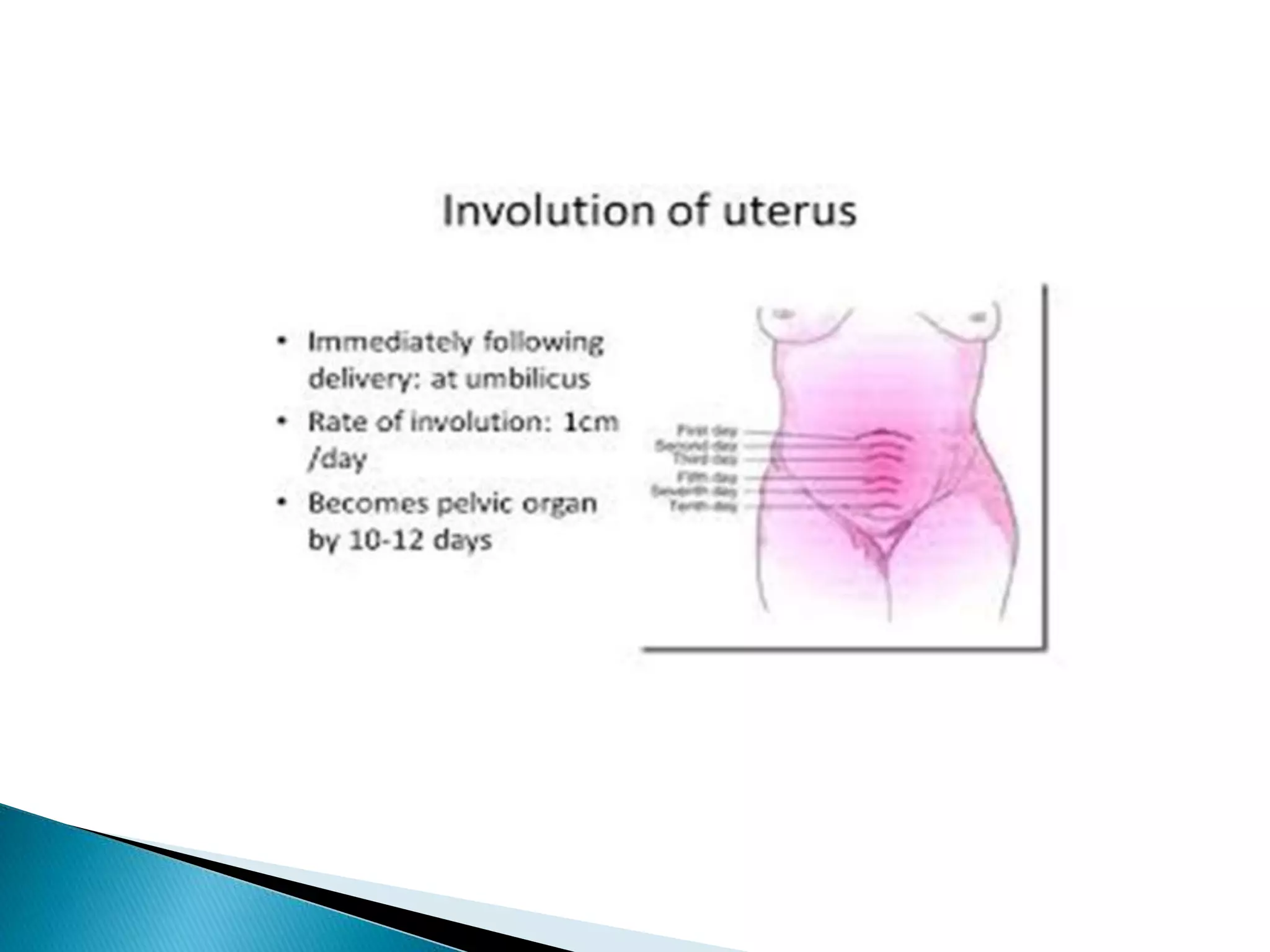 Subinvolution of the uterus | PPTX