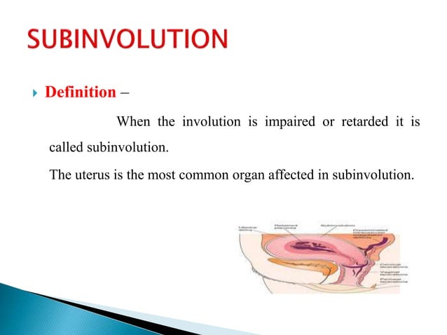 Subinvolution of the uterus | PPTX