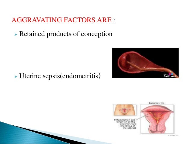 Subinvolution of the uterus