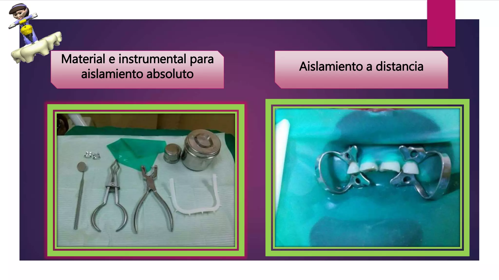CASO CLINICO DE UN ABSCESO ALVEOLAR AGUDO | PPT