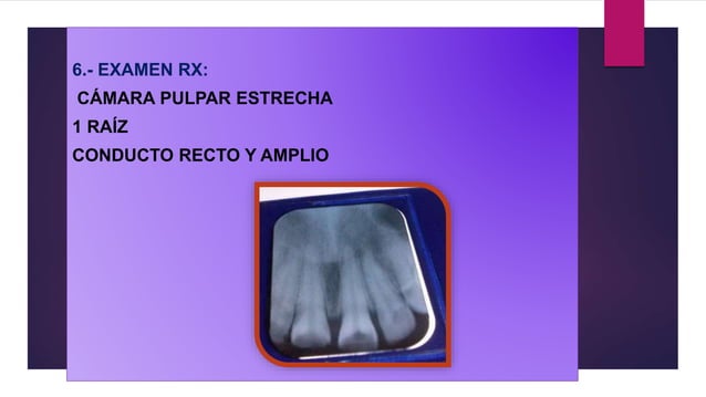CASO CLINICO DE UN ABSCESO ALVEOLAR AGUDO | PPTX
