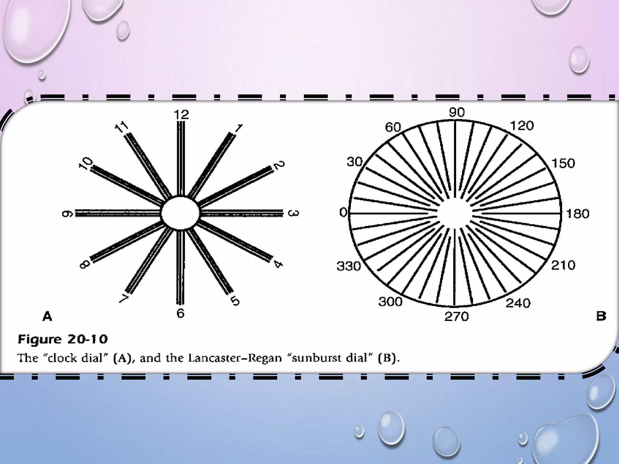 Subjective methods of Refraction | PPTX