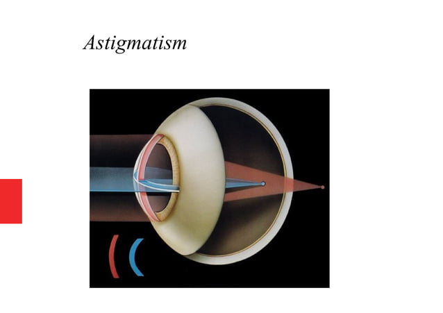 Subjective refraction final | PPT