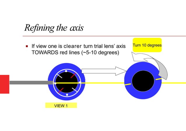 Subjective refraction final | PPT