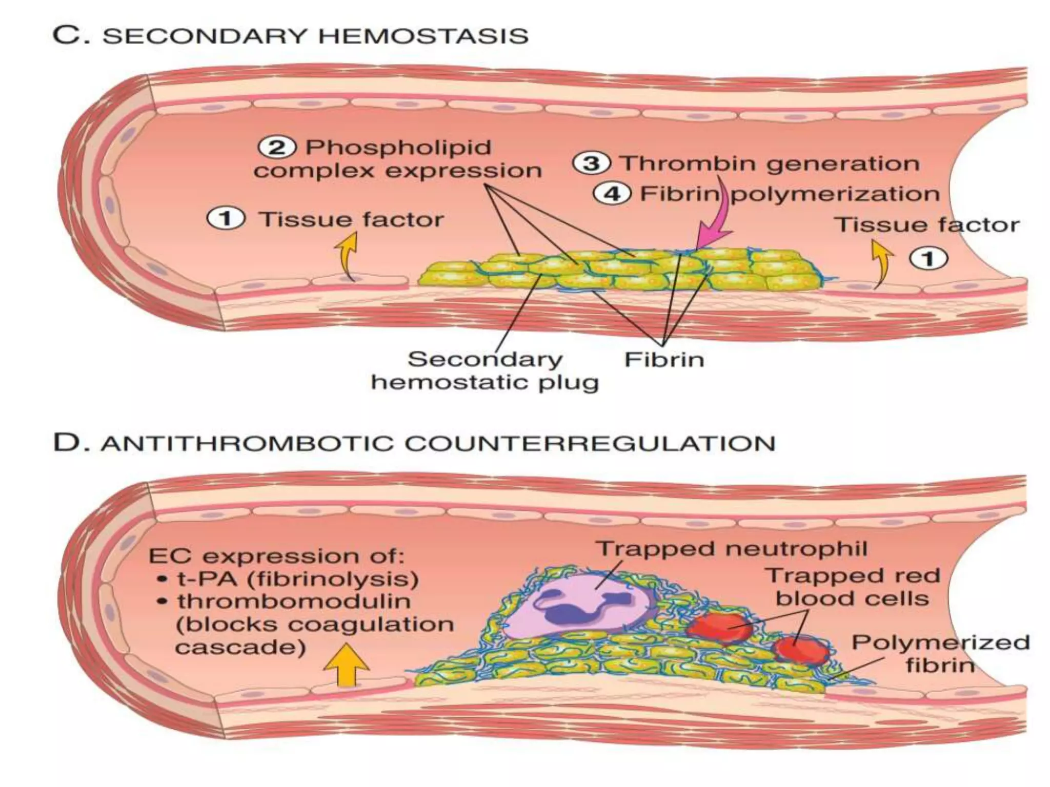 Approach To Patient With Platelet Disorders Ppt
