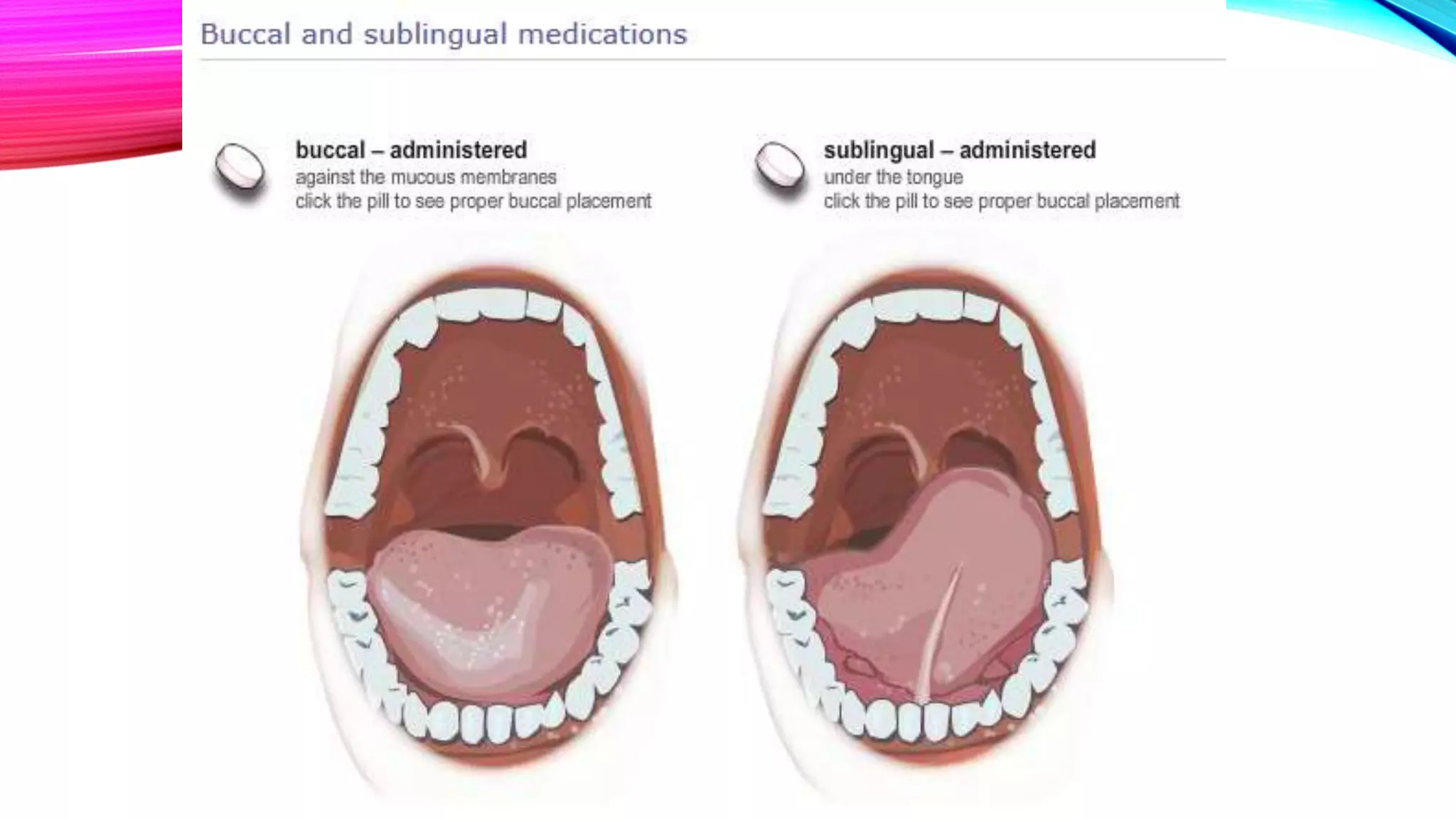 Sublingual tablets | PPTX