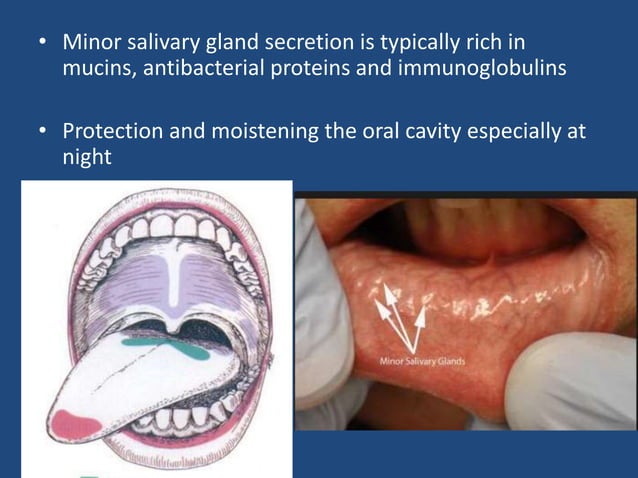 SUBLINGUAL SALIVARY GLANDS.pptx | Ear, Nose and Throat Conditions ...