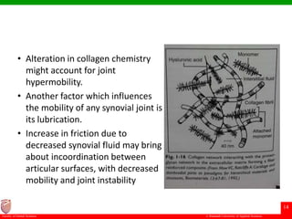 Subluxation and dislocation of temporomandibular joint | PPTX