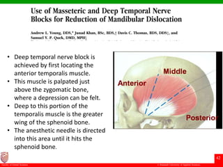 Subluxation and dislocation of temporomandibular joint | PPTX